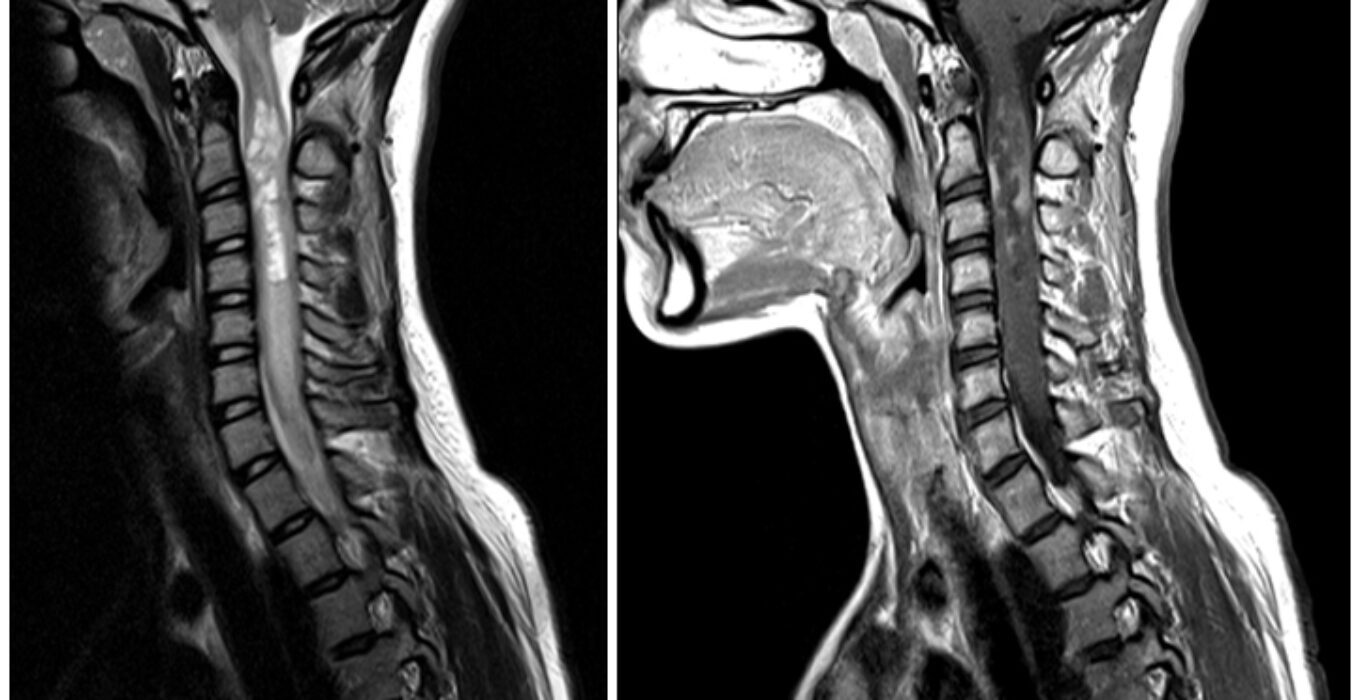 Servikal MR Fiyatları 2023- Emar Tomografi Görüntüleme