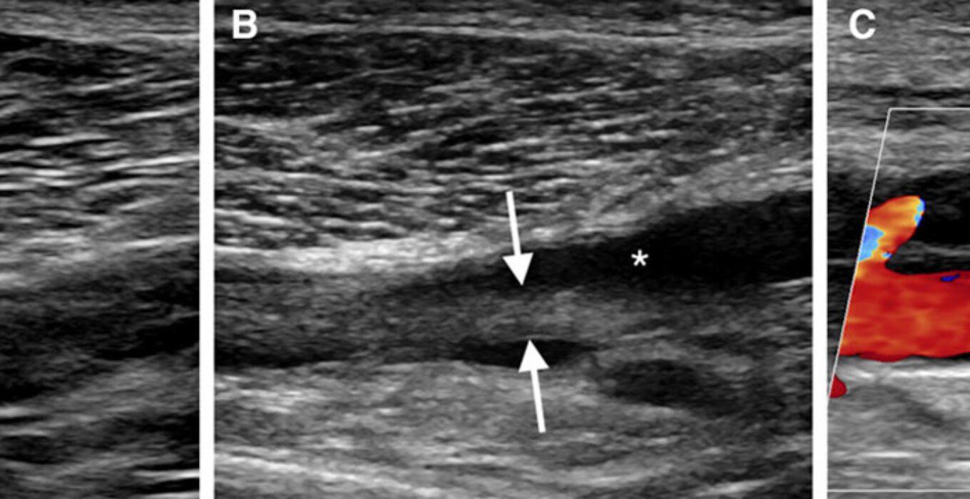 Venöz Doppler Fiyatları 2023- Emar Tomografi