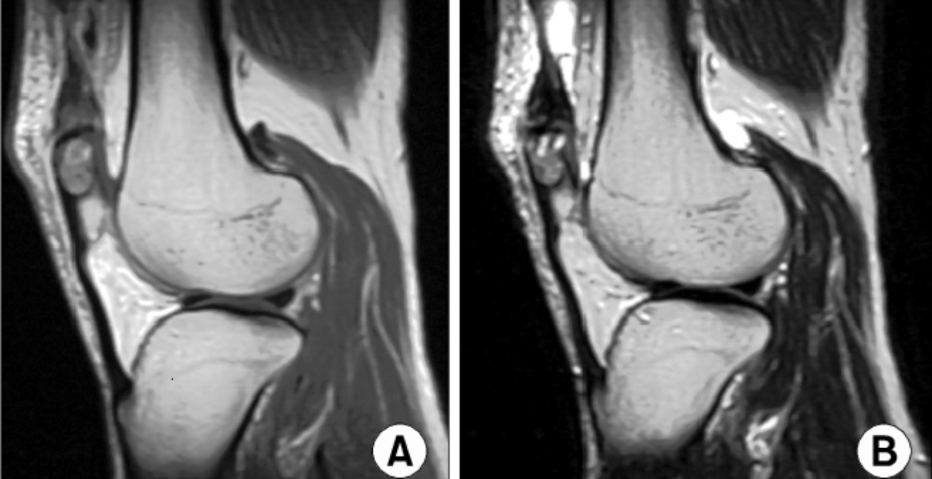Diz MR Fiyatları 2023 - Emar Tomografi Görüntüleme