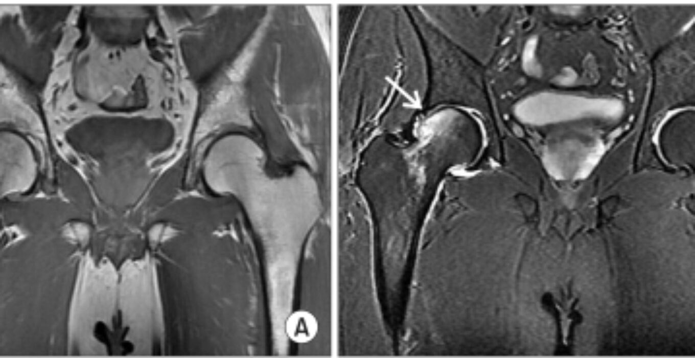 Kalça MR Fiyatları 2023 - Emar Tomografi Görüntüleme