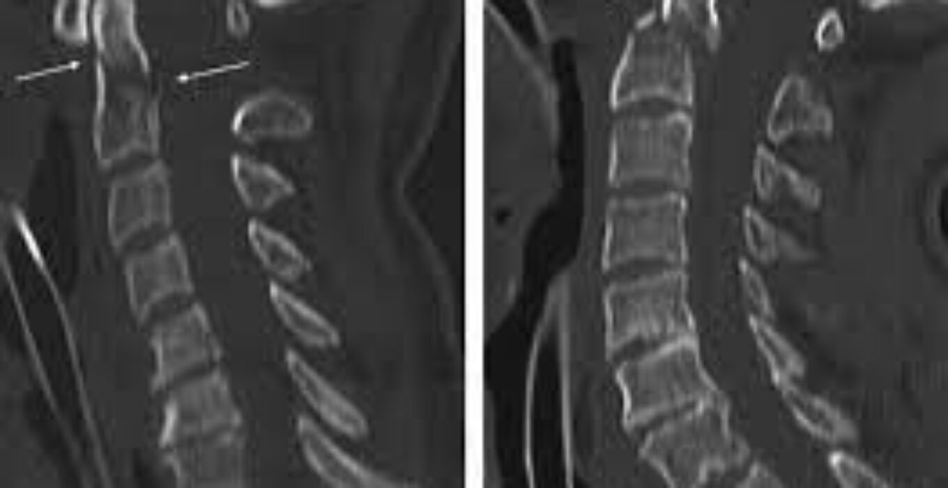 Servikal BT Fiyatları 2023 - Emar Tomografi