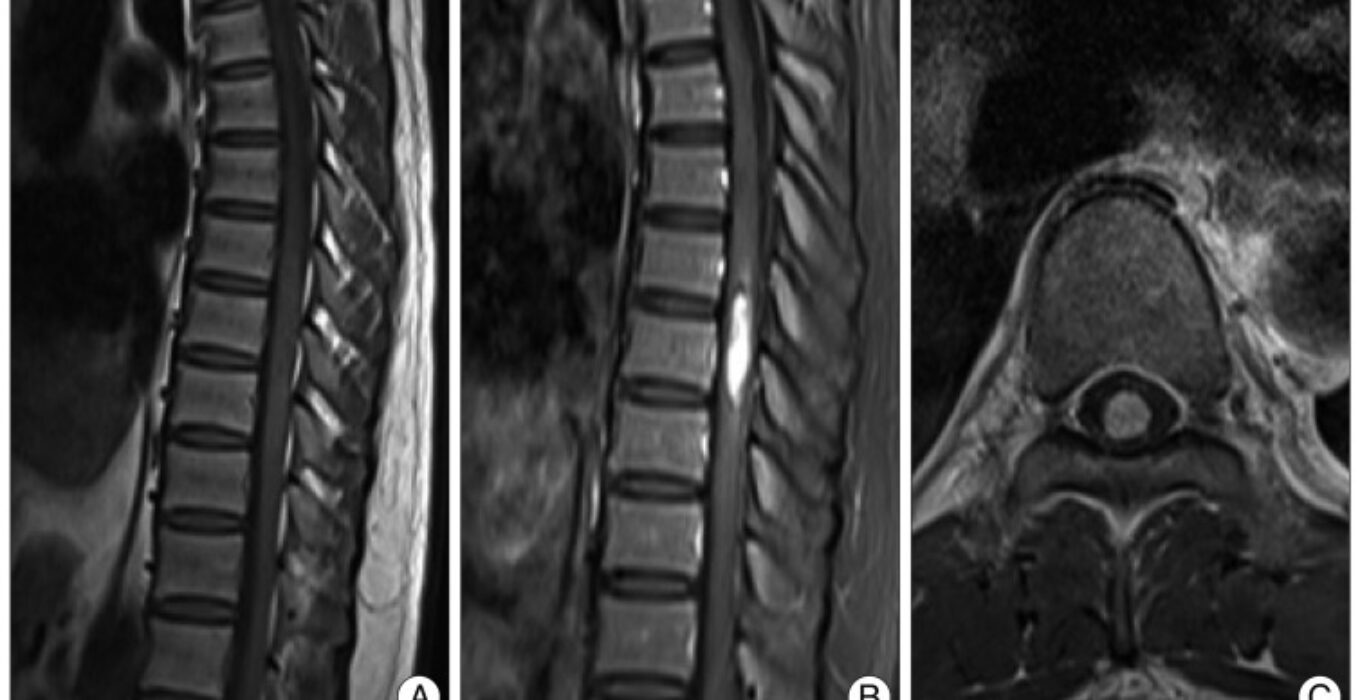 Torakal Vertebra MR Fiyatları 2023 - Emar Tomografi