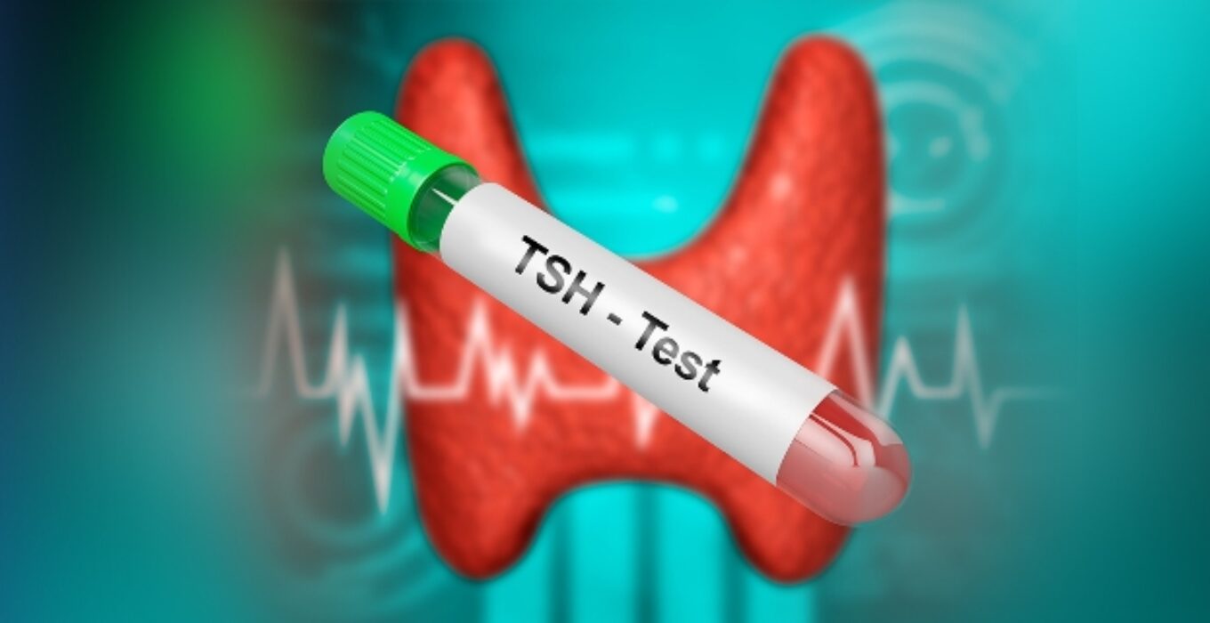 TSH Testi Fiyatları 2023 - Emar Tomografi Laboratuvar