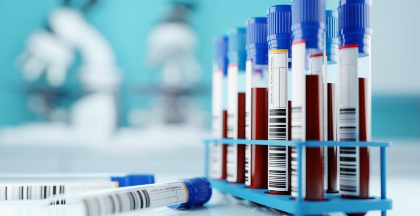 CA 15-3 Kan Testi Fiyatları 2023 - Emar Tomografi