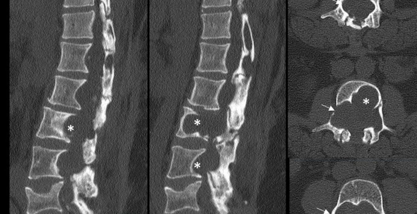 Lomber BT Fiyatları 2023 - Emar Tomografi Görüntüleme