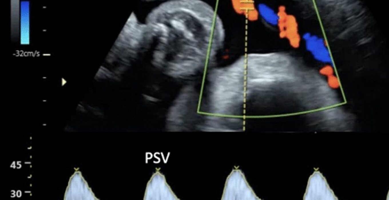 Obstetrik Renkli Doppler Fiyatları 2023 - Emar Tomografi