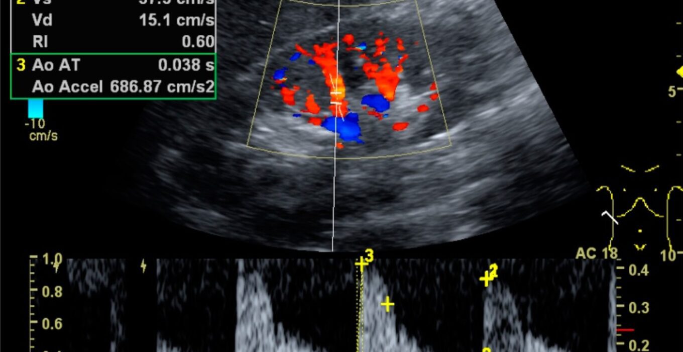 Renal Doppler Ultrason Fiyatları 2023 - Emar Tomografi