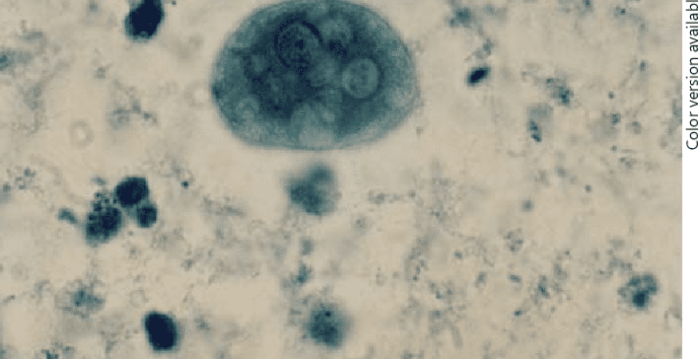 Amip Antikor Testi Fiyatları 2023 - Emar Tomografi