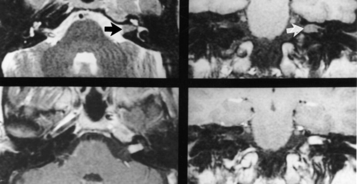 Kulak MR Fiyatları 2023 - Emar Tomografi Görüntüleme