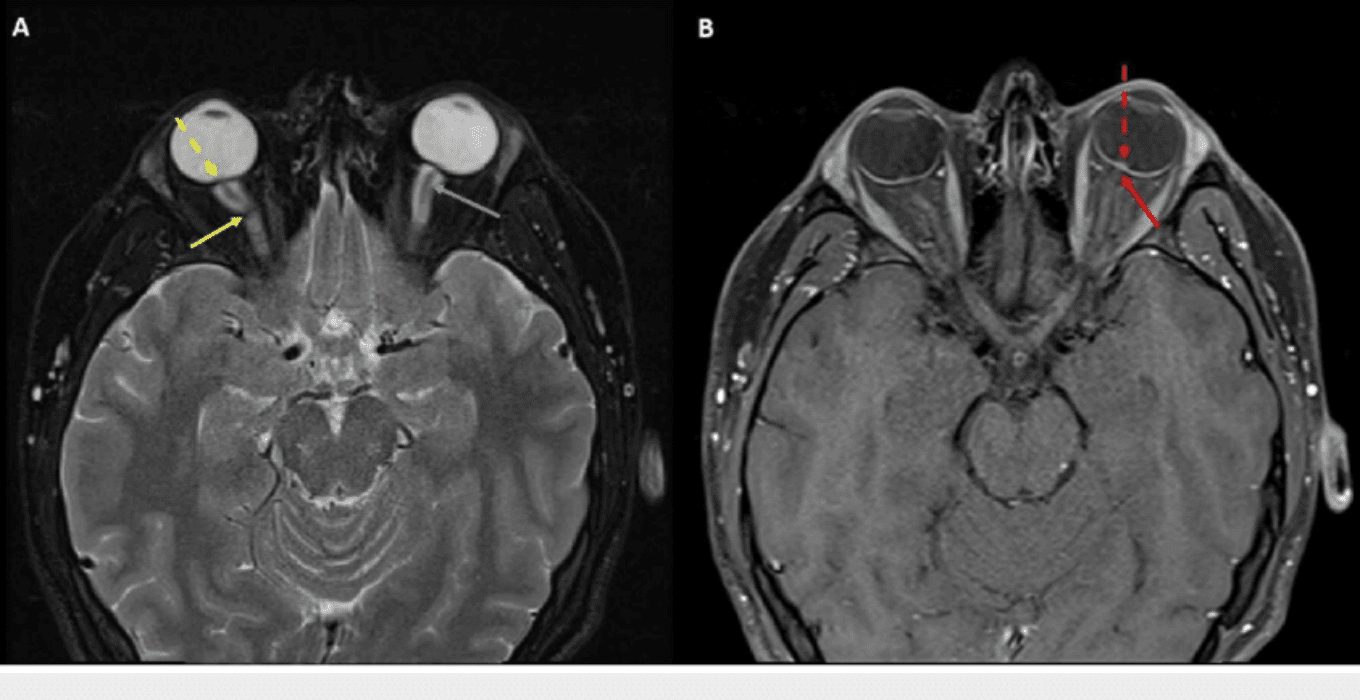 Orbita MR Fiyatları 202- Emar Tomografi Görüntüleme