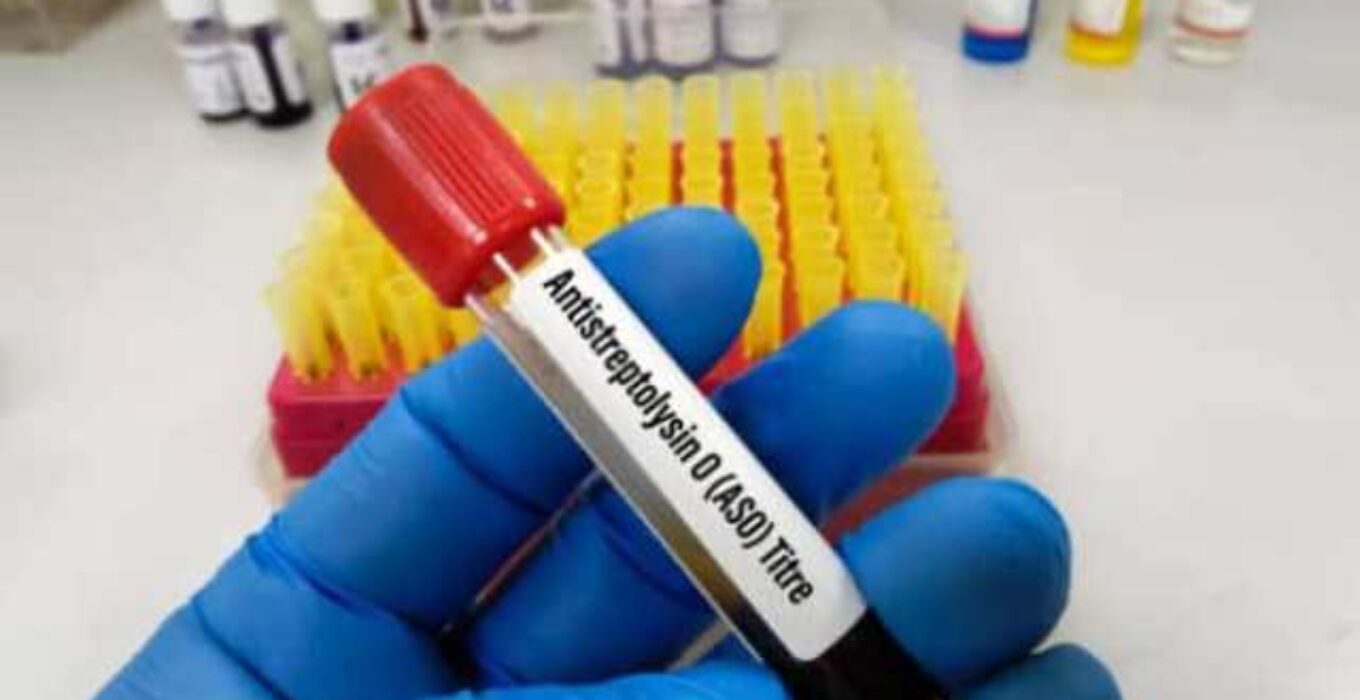 ASO testi Fiyatları 2023- Emar Tomografi Laboratuvar