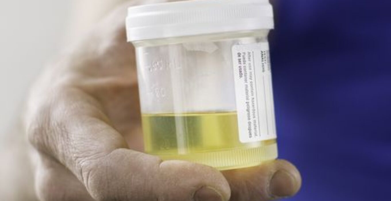 Glukoz idrar testi Fiyatları 2023- Emar Tomografi