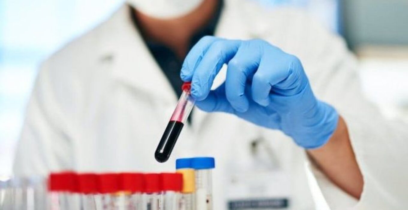 Kan Gazı Testi Fiyatları 2023 - Emar Tomografi