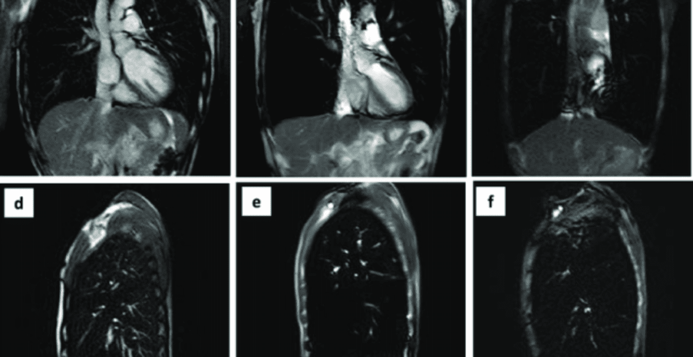 Toraks MR Fiyatları 2023 - Emar Tomografi