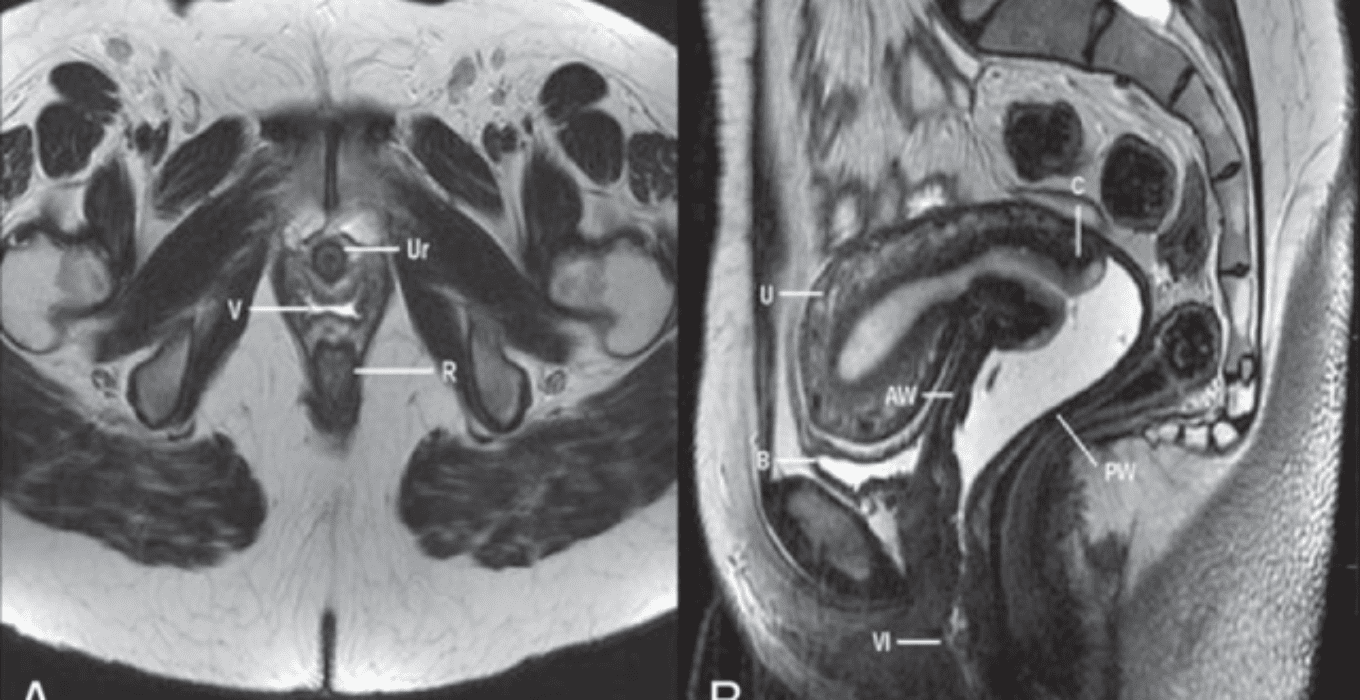 Pelvis MR Fiyatları 2023- Emar Tomografi