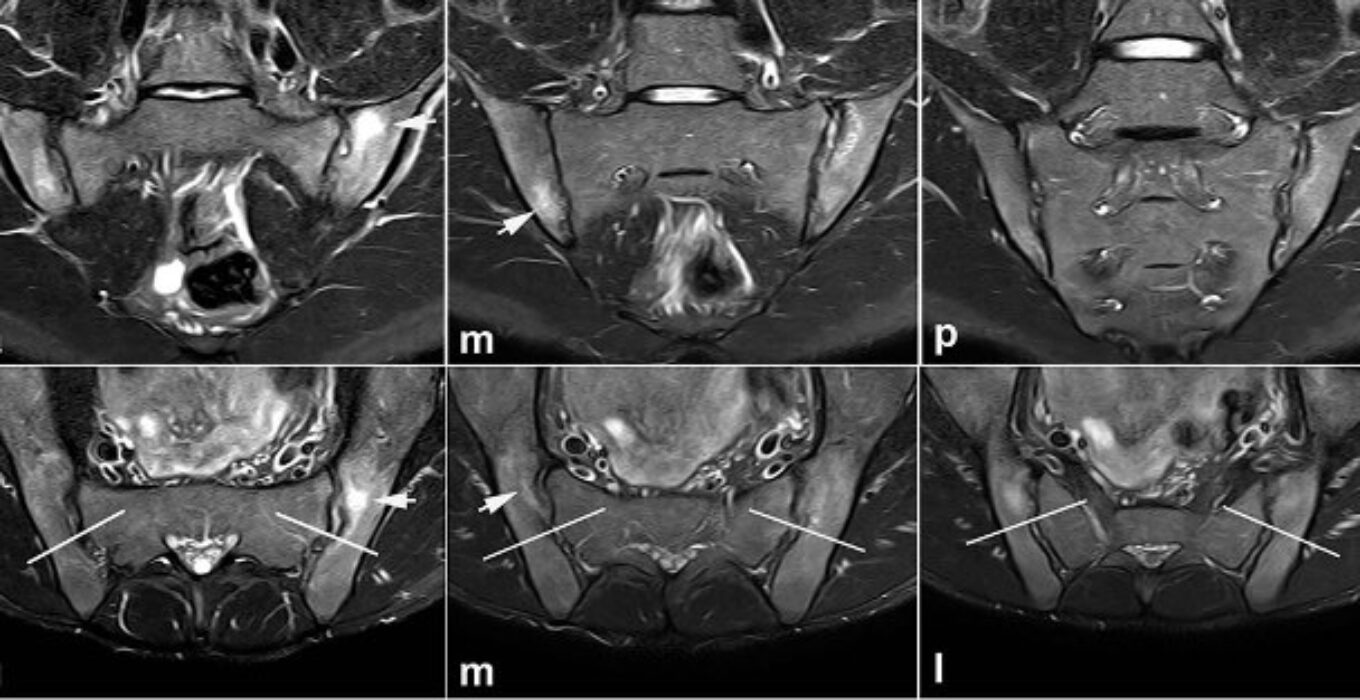 Sakroiliak Eklem MR Fiyatları 2023 - Emar Tomografi
