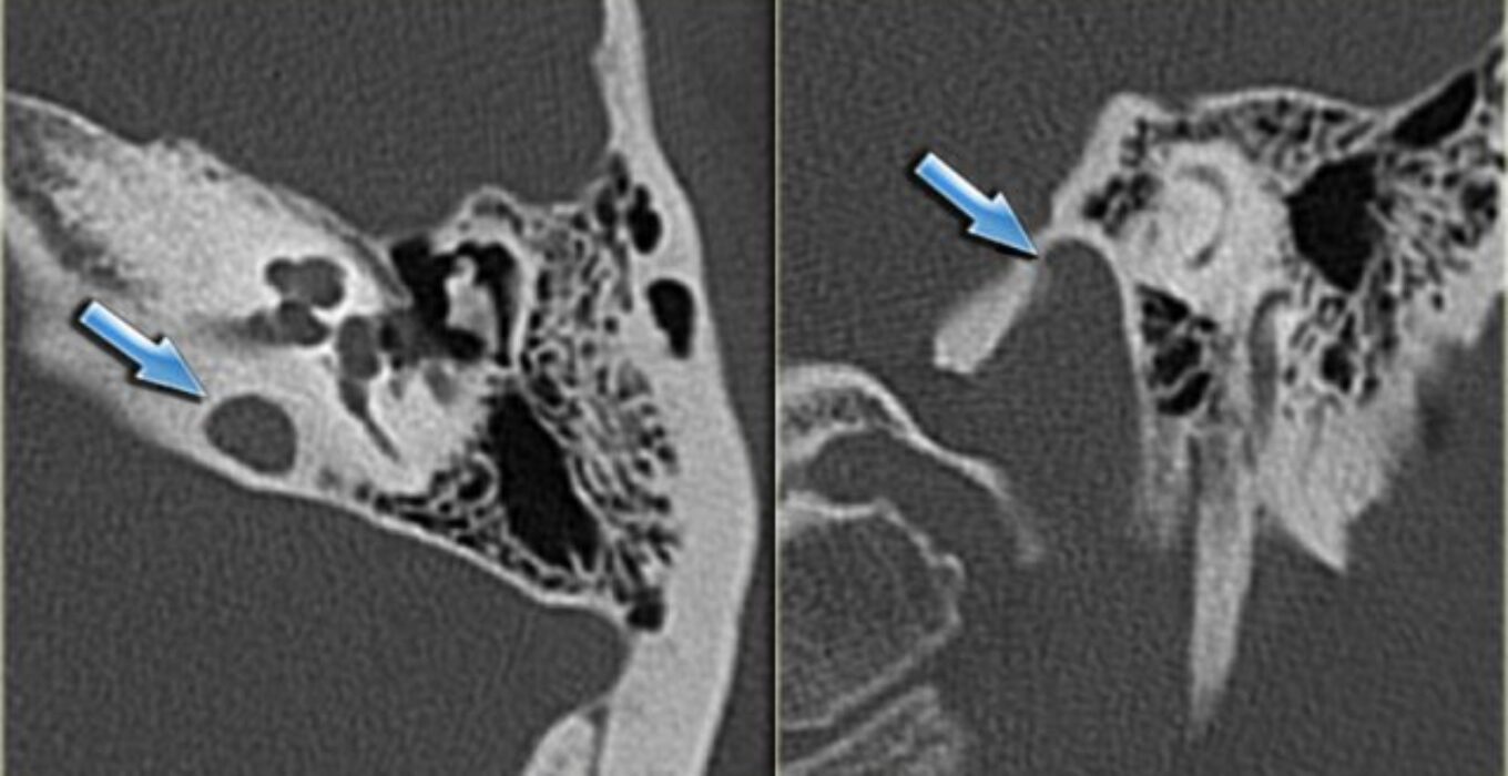 Temporal Kemik BT Fiyatları 2023 - Emar Tomografi