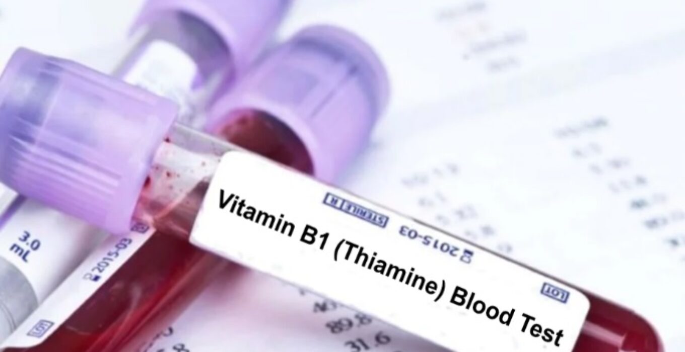 B1 Vitamini Tiamin Testi - Emar Tomografi Laboratuvar
