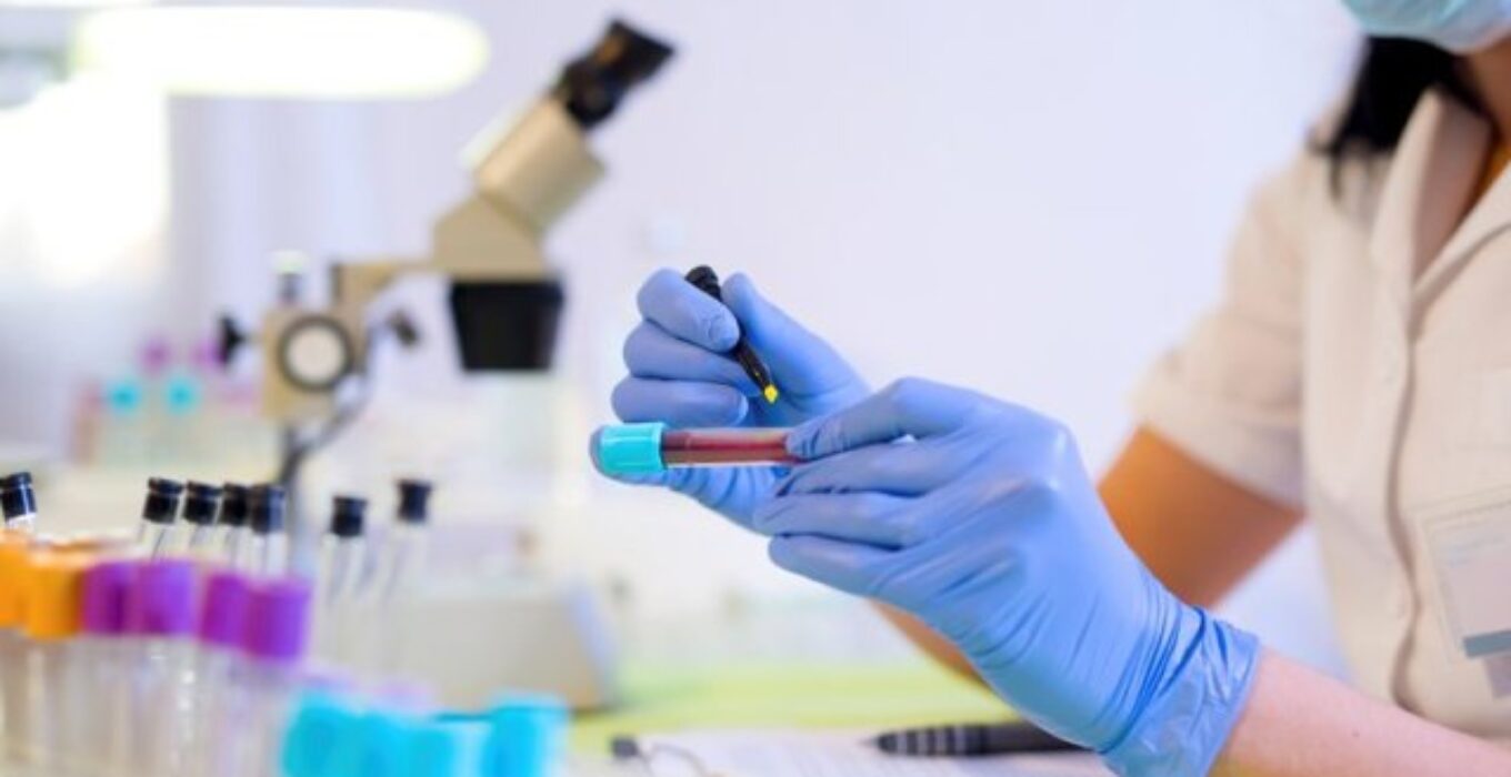 Hemoglobin elektroforezi - Emar Tomografi