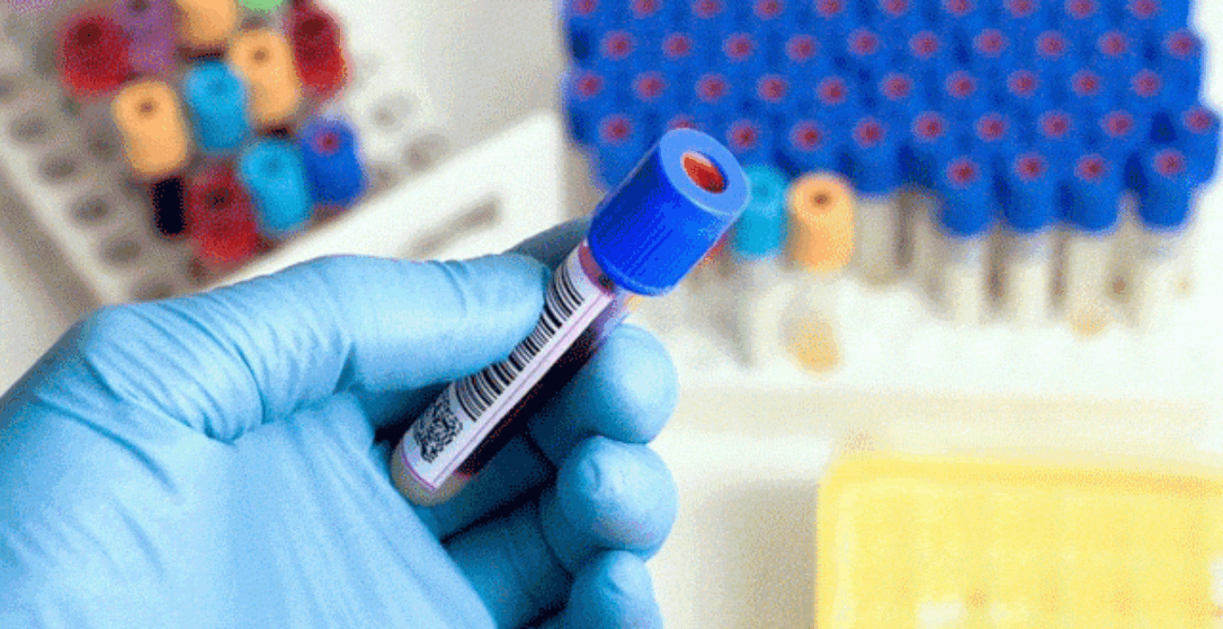 Trombosit Antikorları Kan Testi: Pıhtılaşma Sistemini Anlamak - Emar ...